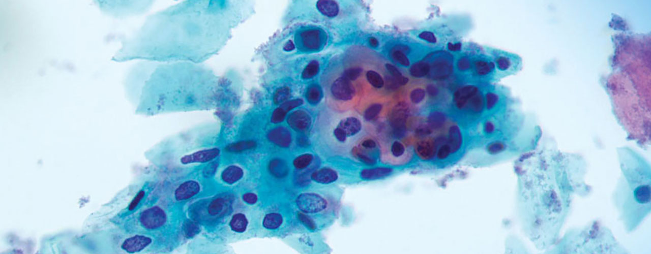 NYSCLA | New York Clinical Laboratory Association